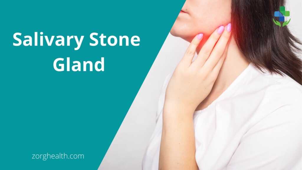 Salivary stone gland Causes, Symptoms and Surgery - Zorg Health