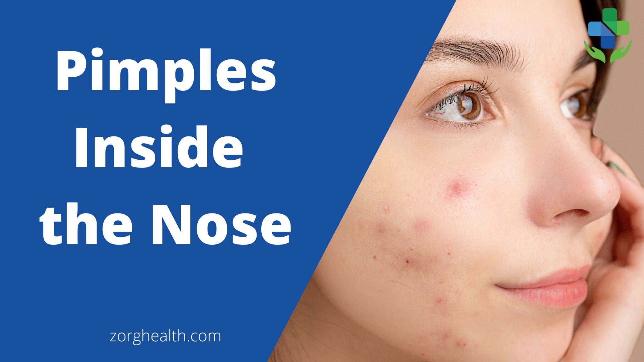 Learn about Pimples Inside the Nose - Zorg Health